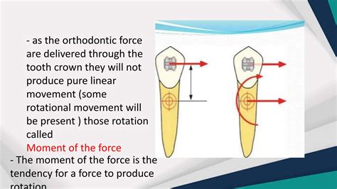 Types Of Tooth Movement Orthodonticpptx