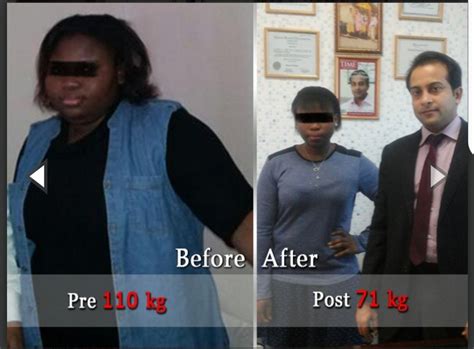 Dr Rajat Goel On Linkedin Surgery Energy Health Surgery