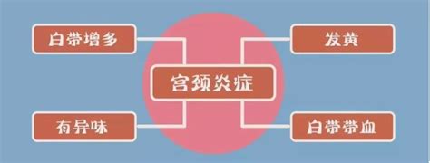 宫颈糜烂二度严重吗 宫颈糜烂怎么引起的 宫颈糜烂怎么治疗