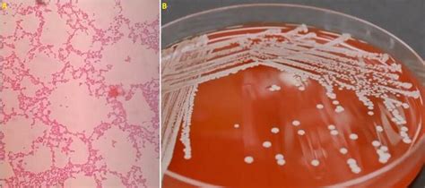 A Blood Agar Showing White Mucoid Colonies Consistent With