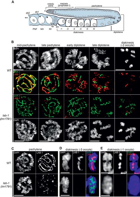 Lab Antagonizes The Aurora B Kinase In C Elegans
