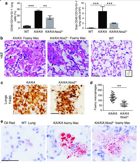 Nos2 Deletion Reduces Infiltrating Macrophage And Foamy Macrophage