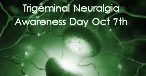Icd 10 Code For Trigeminal Neuralgia Mytrigeminalneuralgia