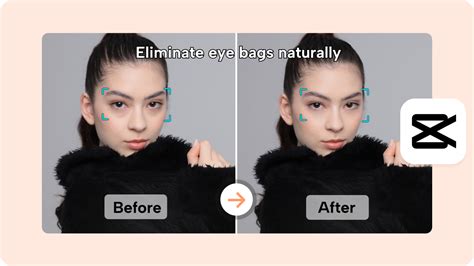 How To Get Rid Of Eye Bags Naturally Safe And Effective Remedies