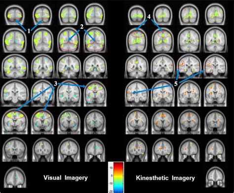 Areas Of Brain Activation For Visual Motor Imagery And Kinesthetic Download Scientific Diagram