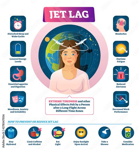 Jet Lag Vector Illustration Labeled Long Flight Disease Feeling