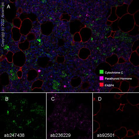 重组parathyroid Hormone抗体 Sp151 Ab130759abcam
