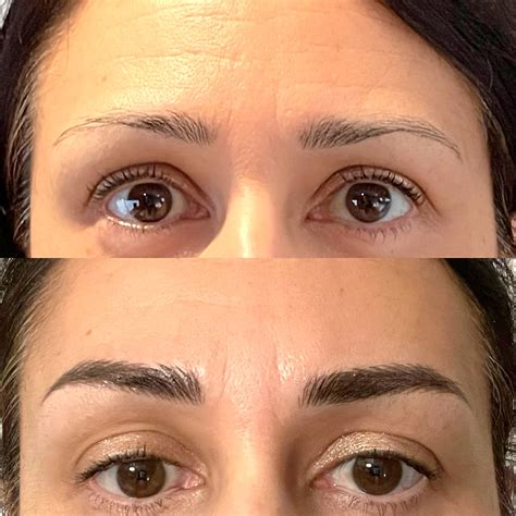 The Early Days Of Microblading Healing