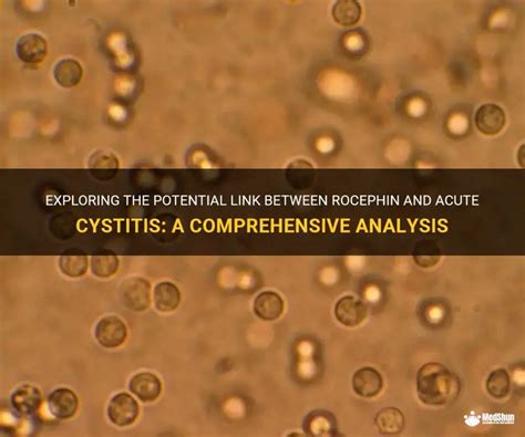 Exploring The Potential Link Between Rocephin And Acute Cystitis A Comprehensive Analysis Medshun