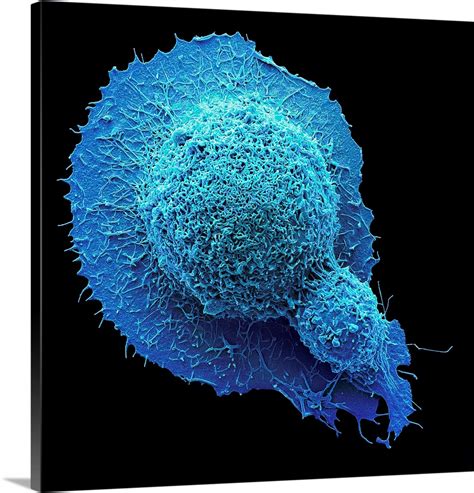Colorectal Cancer Cell Sem Great Big Canvas