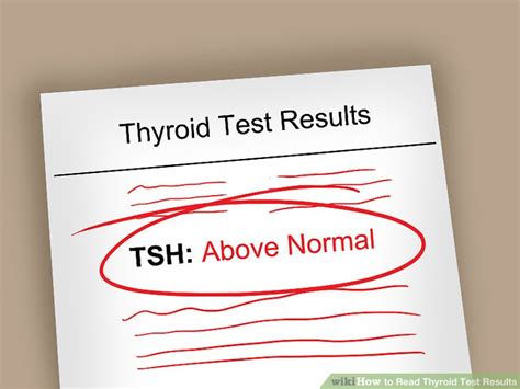 How To Read Thyroid Test Results Steps With Pictures