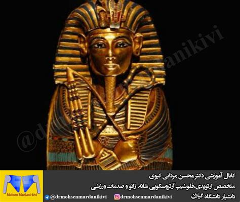 شاید فرعون مصر باستان اولین انسان غول‌پیکر بوده است