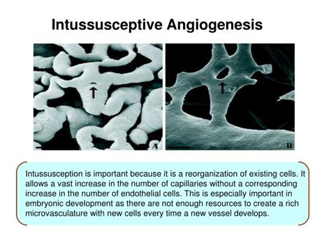 Ppt Angiogenesis Powerpoint Presentation Id6745251