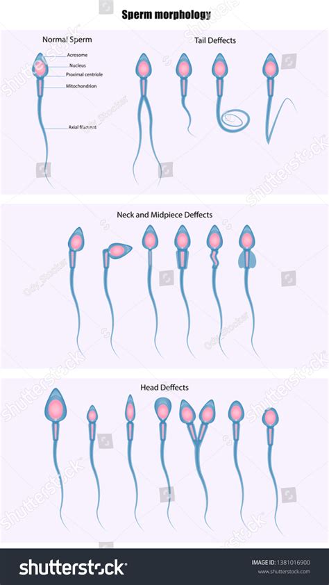 Sperm Morphology Semen Analysis Vector Illustration Stock Vector