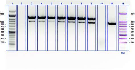 Gradient Pcr Amplification Of The 16s18s Rrna Genes From Haematococcus