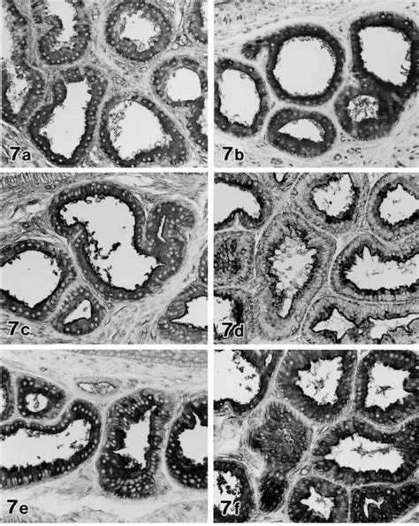 Lectin Histochemical Staining In The Ciliary Glands A The Secretory Download Scientific