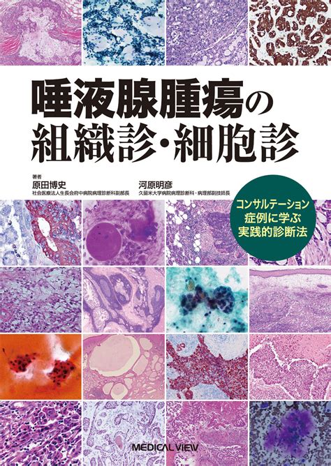 メジカルビュー社｜基礎医学関連｜唾液腺腫瘍の組織診・細胞診