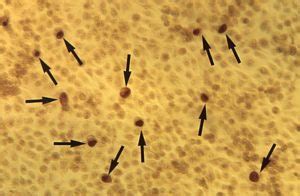 Difference Between Chlamydia And Trichomonas Difference Between