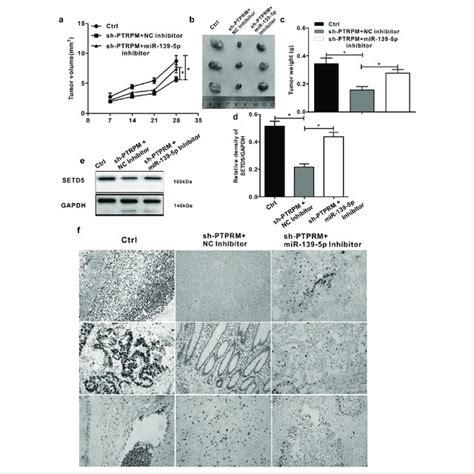 Circptprm Contributes To Tumor Growth Of Nsclc Via Mir 139 5psetd5