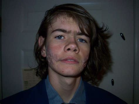 Heath Ledger Joker Scars