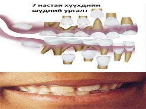 сүүн шүд болон байнгын шүдний онцлог