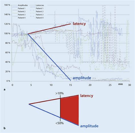 9 A Complete Loss Of Signal During Active Continuous Intraoperative Download Scientific Diagram