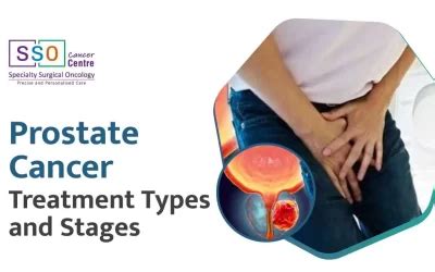 Prostate Cancer Treatment Types Options And Side Effects