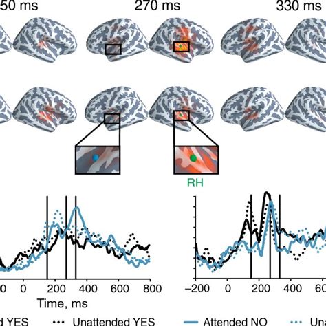 Source Estimation Of The Meg Evoked Responses Corroborates Attention Download Scientific