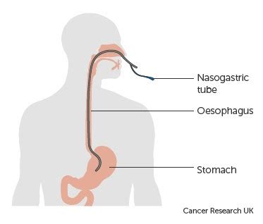 Ukuran Selang Ngt Y Soalan