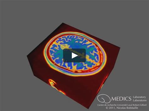 mri slicing color magnetic resonance imaging magnetic resonance