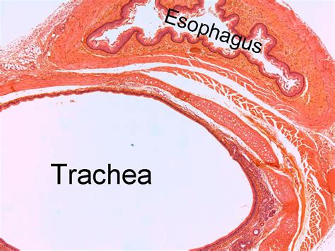 DIAGRAM Diagram Of The Esophagus And Trachea MYDIAGRAM ONLINE