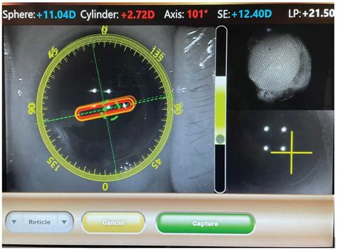 Ophthalmology Management Pentavision