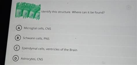 Identify This Structure Where Can It Be Founda Microglial Cells Cns