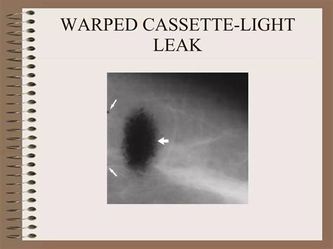 Radiographic Artifacts Ppt Science