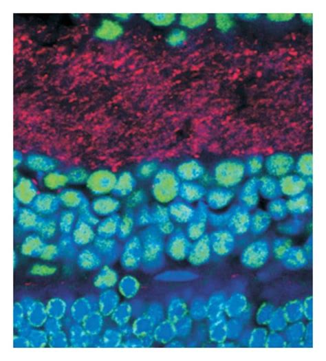 Synapsin 1 Polyclonal Antibody Invitrogen™ 100 μl Unconjugated