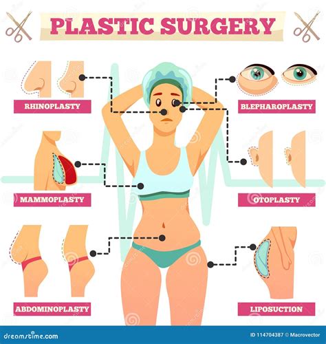 Plastic Surgery Orthogonal Flowchart Stock Vector Illustration Of Aesthetic Equipment 114704387