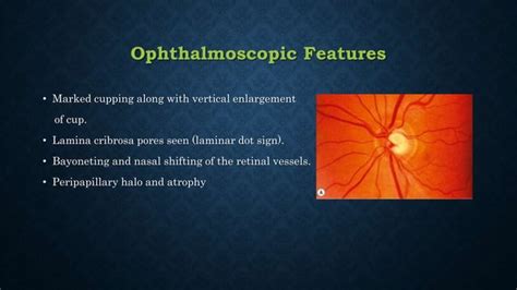 Optic Atrophy Ppt Pptx