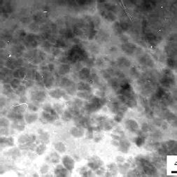 Morphology Of Dendrites A And Precipitated Phase B Of Cr For A Cast