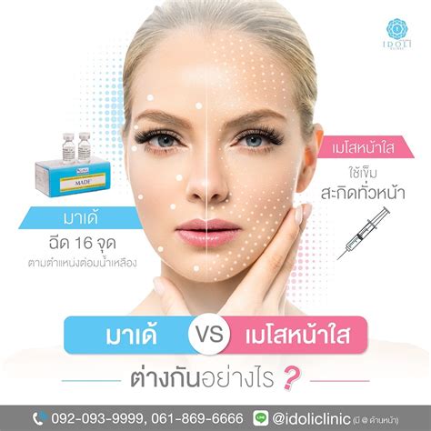 💉มาเด้คอล Idl Clinic ไอดีแอลคลินิก ศัลยกรรมตกแต่งเฉพาะทาง