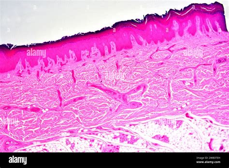 Stratified Squamous Epithelium From Human Hand Skin Showing Keratinized Epidermis And Dermis