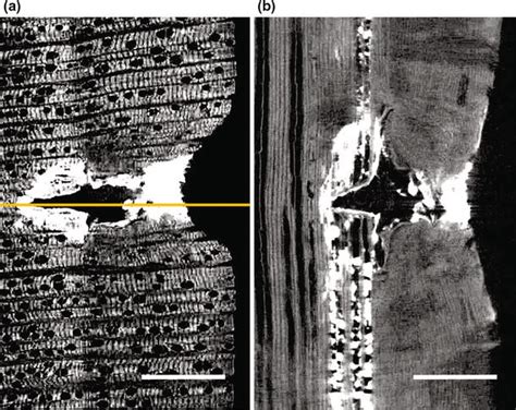 X Ray CT Images Allow To Sample The Best Cross Section For Relative Download Scientific Diagram