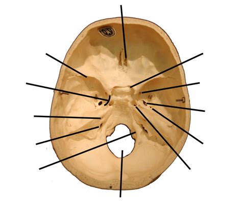 Anatomyzone Cranial Fossa At Martha Ehrlich Blog