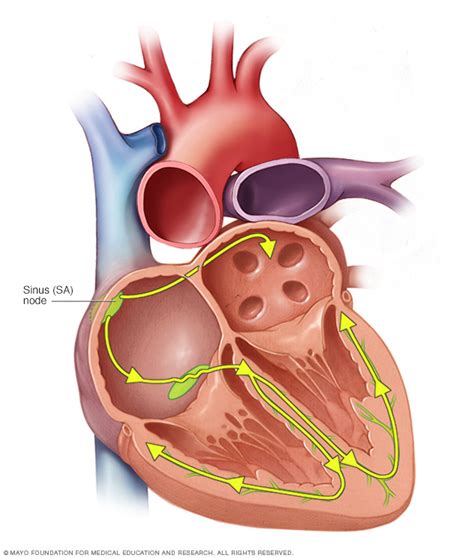 Pacemaker Beacon Health System