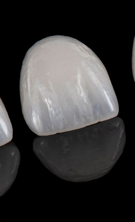 Composite Veneers In Altrincham Trafford Manchester