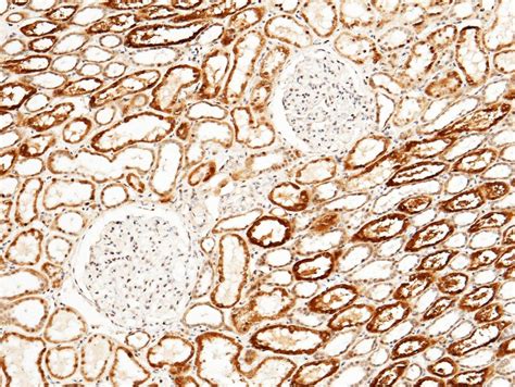 Anti Intestinal Alkaline Phosphatase Antibodies Invitrogen