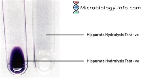 Hippurate Hydrolysis Test Principle Procedure Result 46 Off