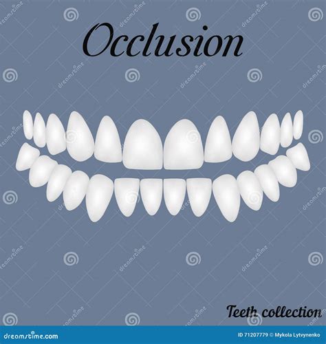 Occlusion Stock Vector Illustration Of Graphic Medical 71207779