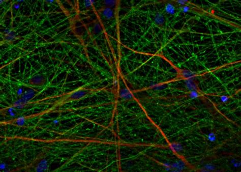Neural Stem Neural Progenitor Cell Nsc Npc Markers Proteintech Group