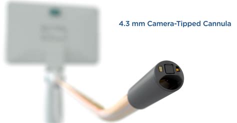 Office Hysteroscopy With Endosee