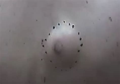 Large Creamy Epidermoid Cyst Drained On Back New Pimple Popping Videos